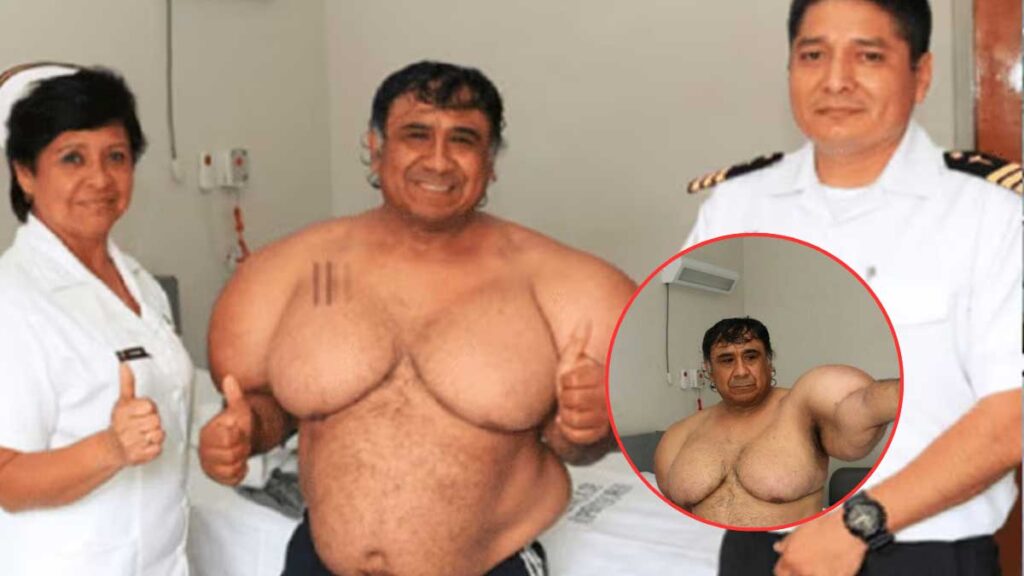 La increíble historia de Alejandro Ramos, el buzo peruano que vive ‘inflado’ tras un accidente ...